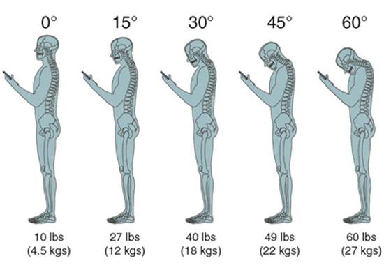 Sitting pretty: How poor posture can pose painful problems | PS News
